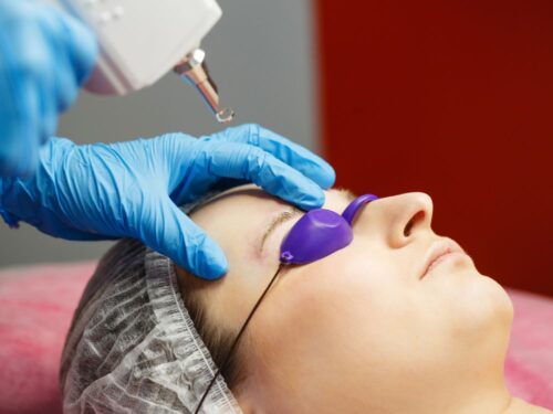Eyebrow Laser Hair Removal: Achieve Long-Lasting Precision