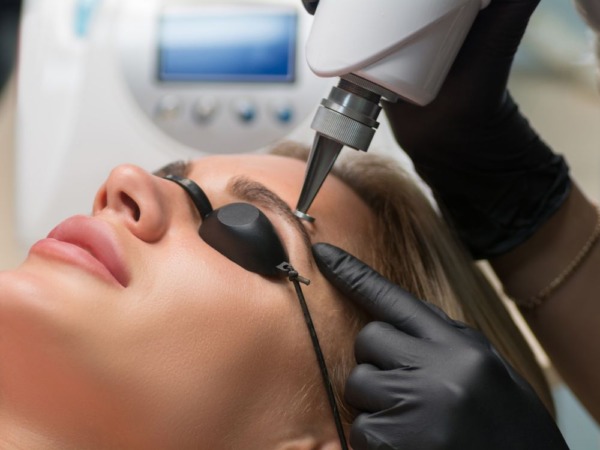 Eyebrow Laser Hair Removal: Achieve Long-Lasting Precision